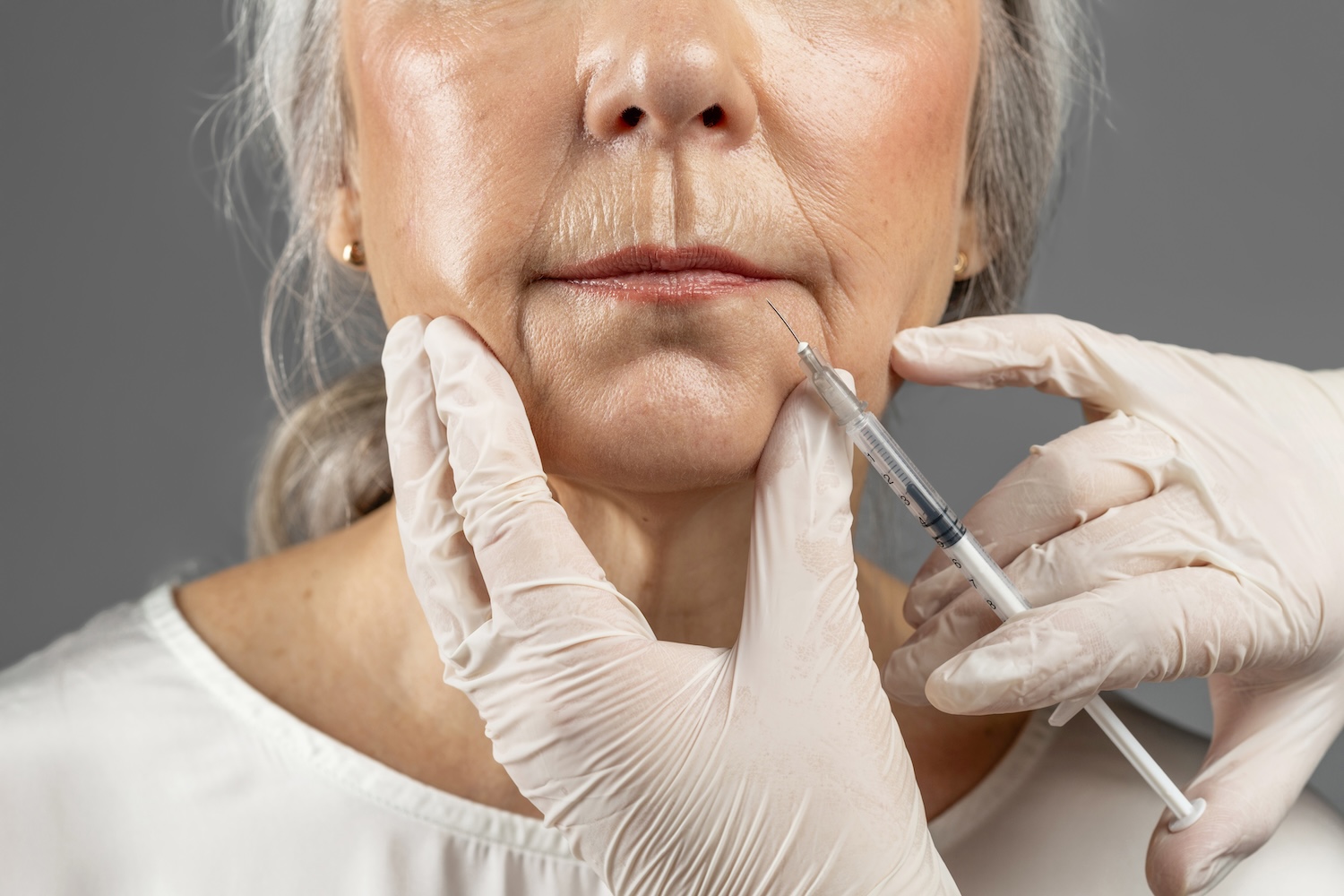 What's the Best Option for Deep Creases on My Face? - 817 Surgical Arts